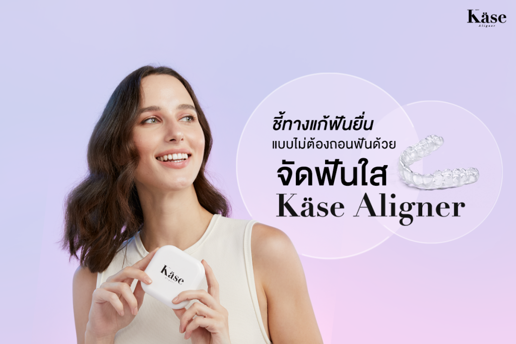 ความใสของ เครื่องมือจัดฟันใส Käse Aligner มีดีอย่างไร? - kasealigner