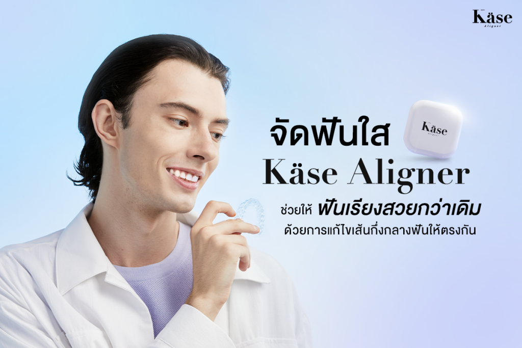 จัดฟันใส Käse Aligner จัดการเคสยากได้เพราะอะไร? - kasealigner