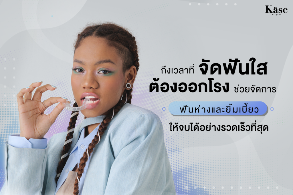 ปุ่มเคลื่อนฟัน PowerCompose กับอุปกรณ์จัดฟันใส - kasealigner