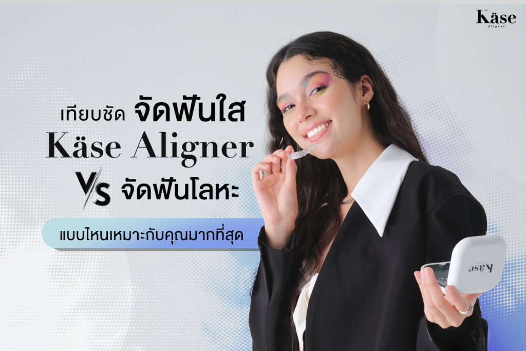ปุ่มเคลื่อนฟัน PowerCompose กับอุปกรณ์จัดฟันใส - kasealigner