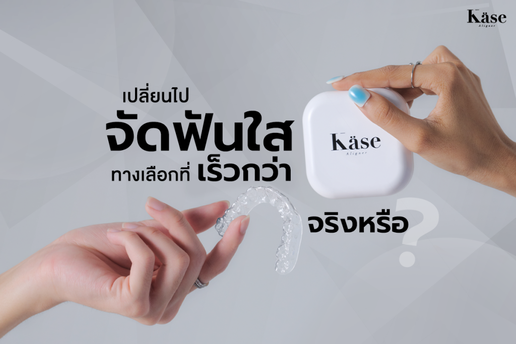 เป๊ะกว่าเดิม เมื่อฟันหน้าเรียงตัวสวยด้วย จัดฟันใส Käse Aligner ...